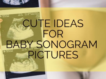 Cute Ideas For Baby Sonogram Pictures – LujaStyles