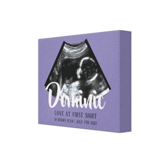 Cute Ideas For Baby Sonogram Pictures – LujaStyles
