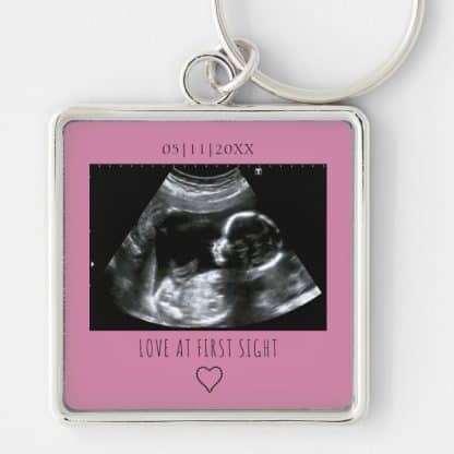 Cute Ideas For Baby Sonogram Pictures – LujaStyles